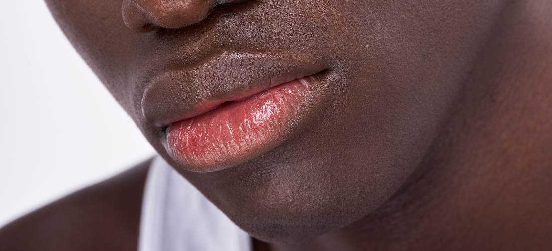 Folliculitis and pseudo folliculitis of the beard: what to do? – Nubiance