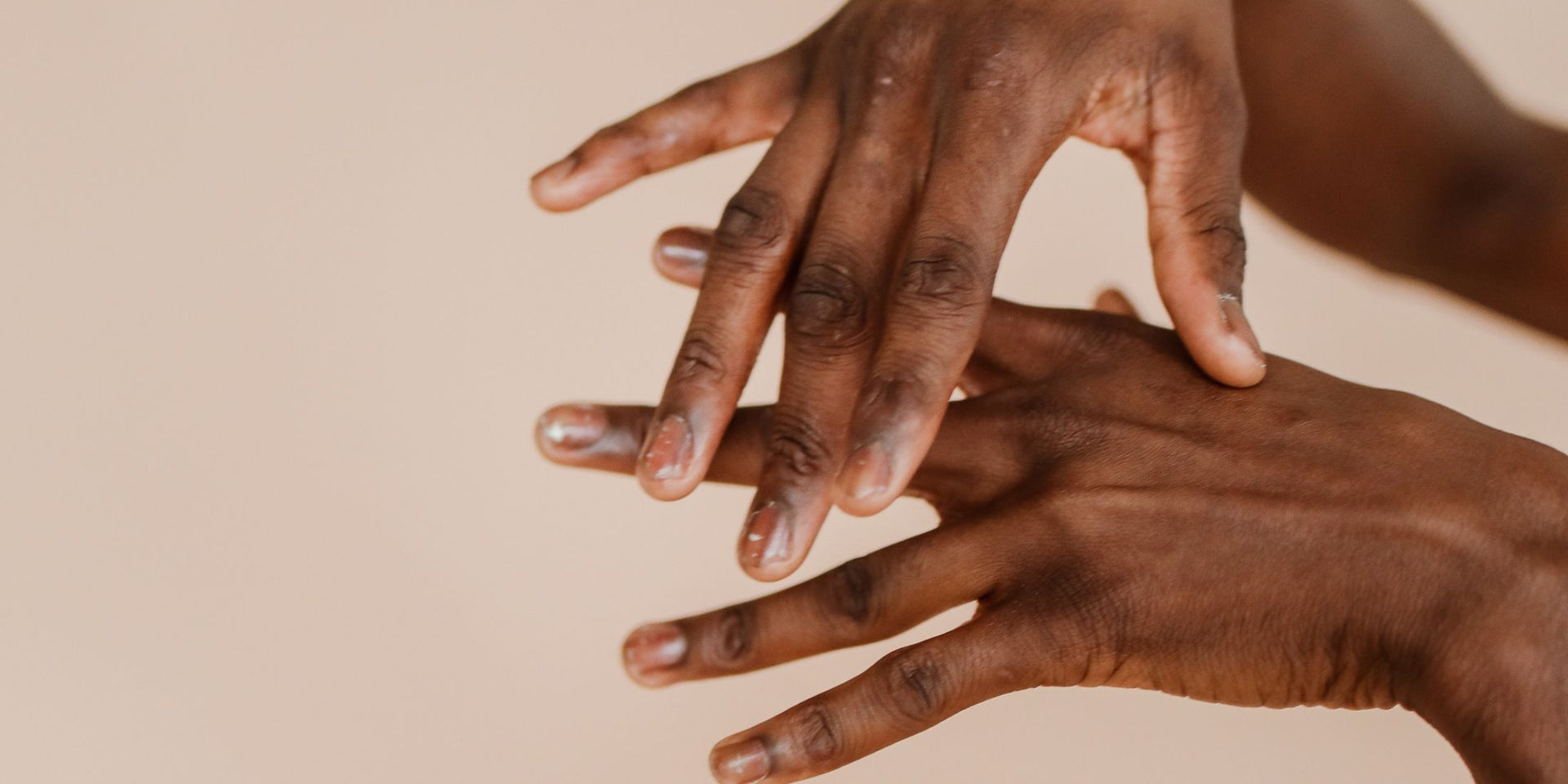 Dépigmentation de la peau : Les essentiels à connaître – Nubiance