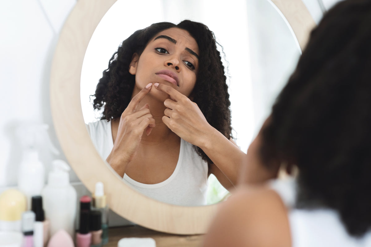 Acné rétentionnelle | Comment la reconnaître et la traiter ? – Nubiance
