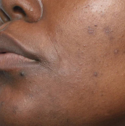 Soins Visage & Corps pour Peaux Noires, Mates & Métissées – Nubiance